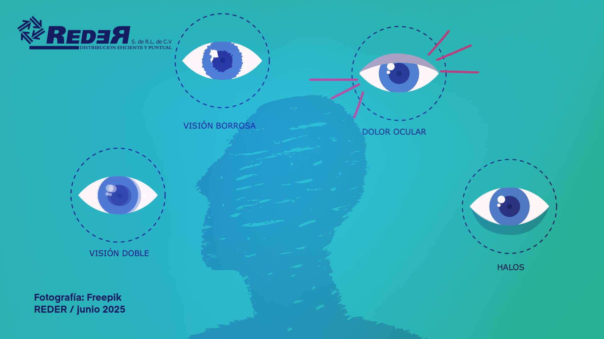 Señales de alerta en la salud visual: ¿Cuándo acudir al oftalmólogo ...